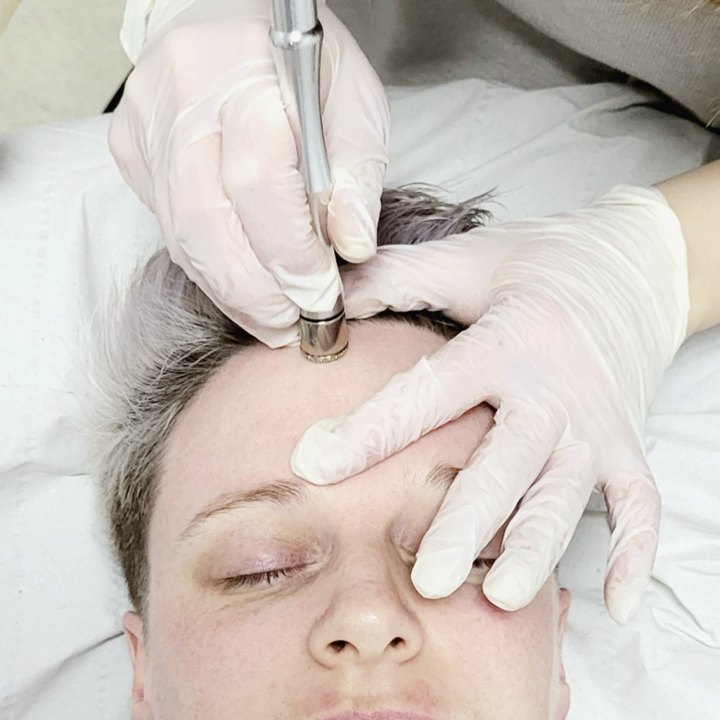 Dermaco Pro Treatments in Blackpool - Oasis Wellbeing Clinic