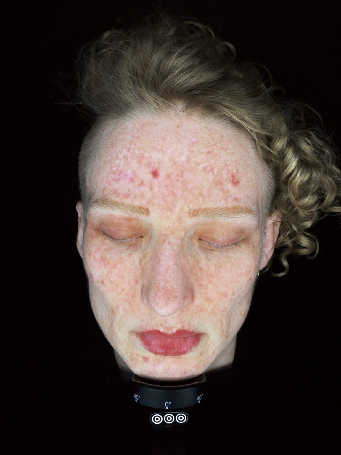 Skin Scanning Assessment - Oasis Wellbeing Clinic